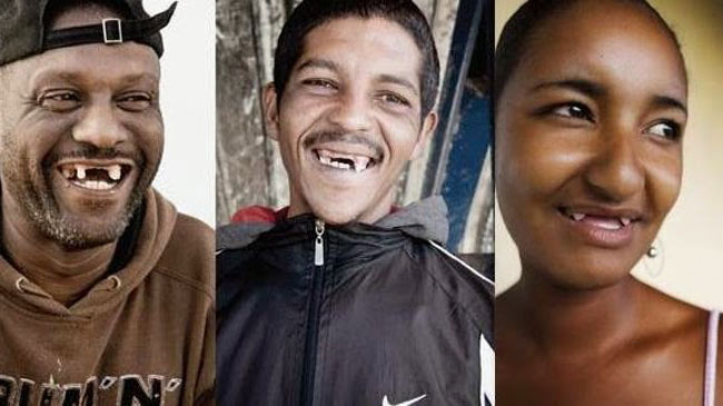 Nhổ một loạt răng cửa để đẹp hơn và có nụ hôn ngọt ngào hơn